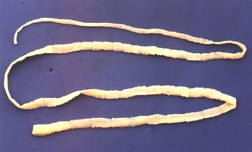 lombrices intestinales: Síntomas, tratamiento, remedios caseros y más